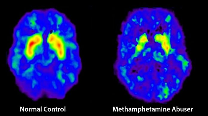 16 Interesting Facts About Methamphetamine - OhFact!